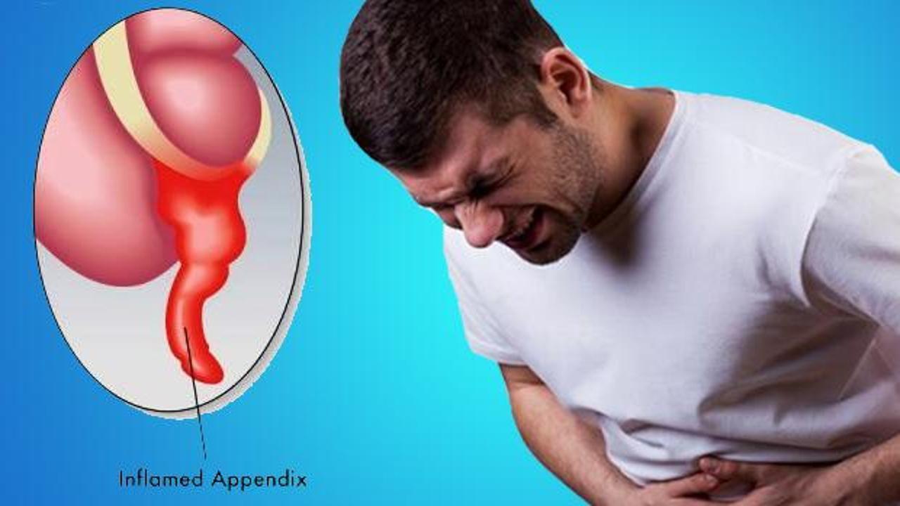Apandisit nedir? Belirtileri nelerdir? - Haber 7 SAĞLIK