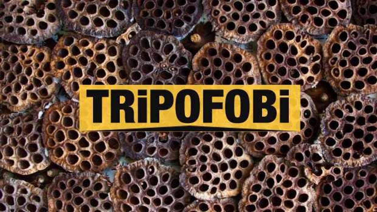 Tripofobi nedir neden olur? Delik fobisi belirtileri ve tedavisi ...