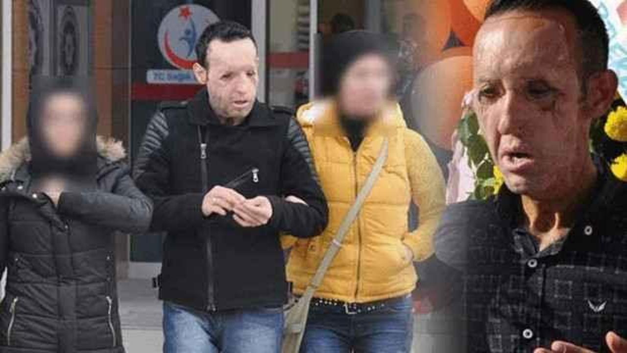 Yüz nakli yapılan Recep Sert'e açılan davada karar! - Haber 7 GÜNCEL