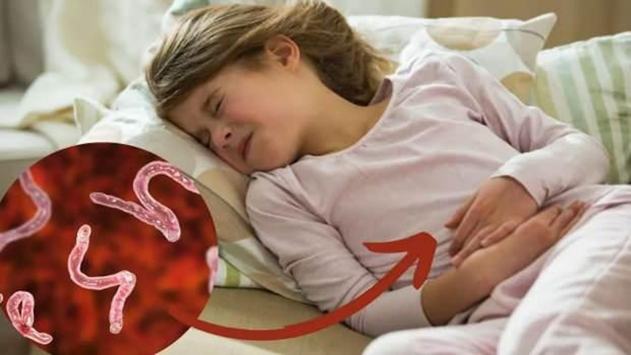 Yetişkinlerde kıl kurdu belirtileri: Bağırsakta kıl kurdu nasıl dökülür ...