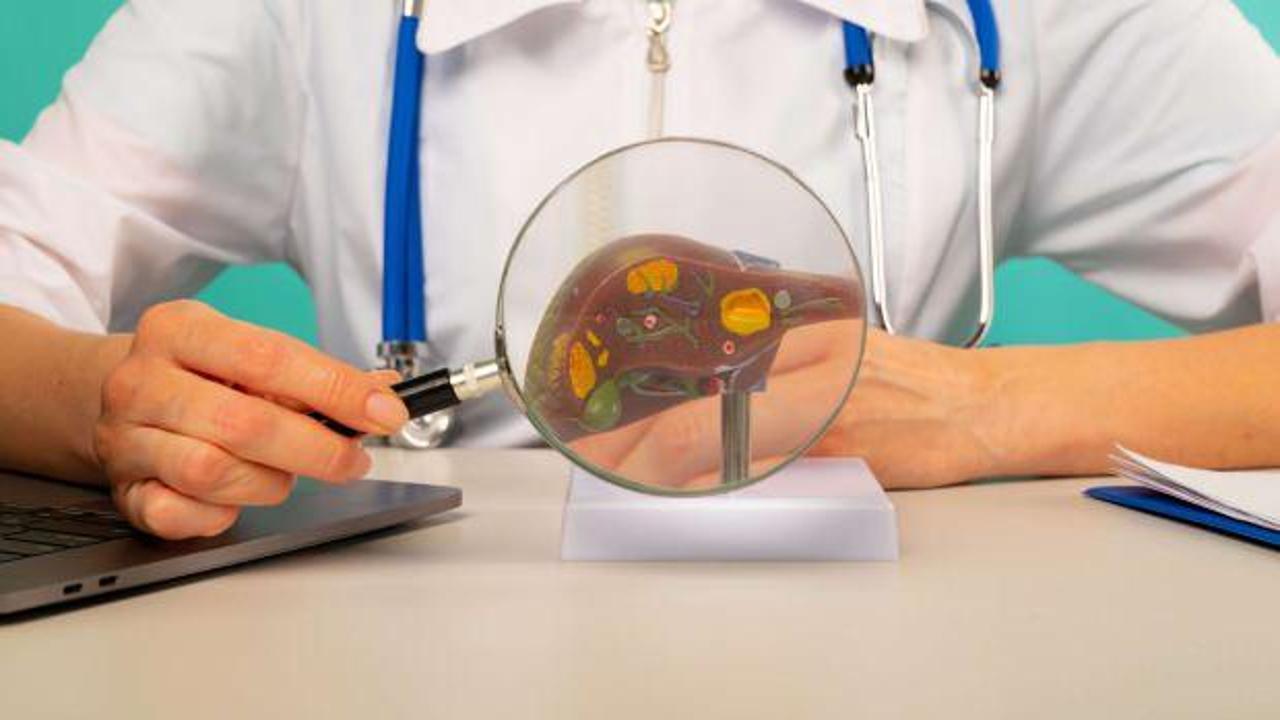 Karaciğer yağlanması neden olur, belirtileri nelerdir? Karaciğer ...