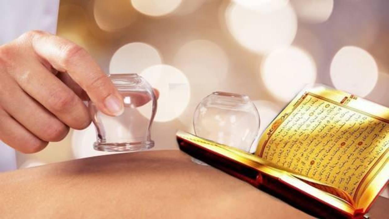 Manevi hacamat bölgeleri ve hacamatın faydaları! Hacamat sünnet mi ...