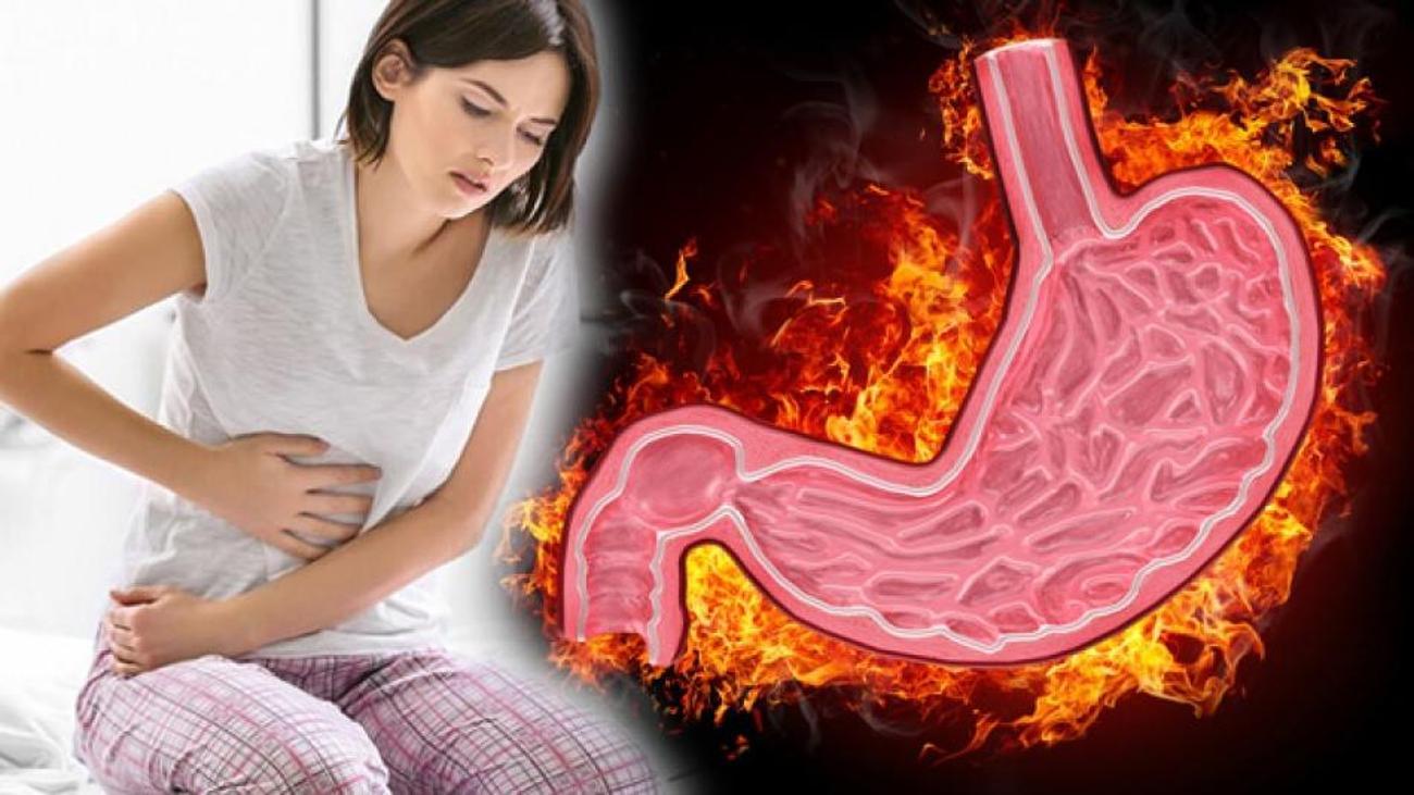 Gastrit nedir? Gastritin belirtileri nelerdir ve tedavisi var mıdır ...