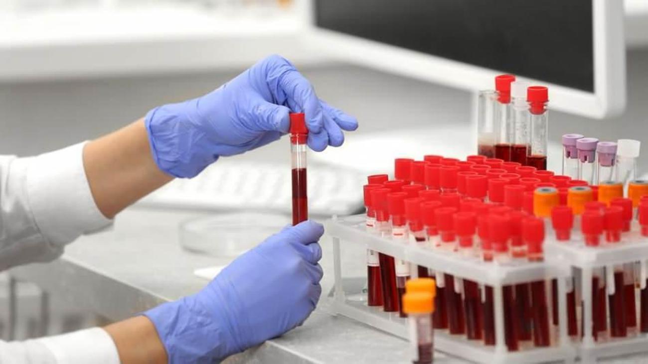 Sedimantasyon testi nedir? Sedimantasyon testi kimlere ve nasıl yapılır ...