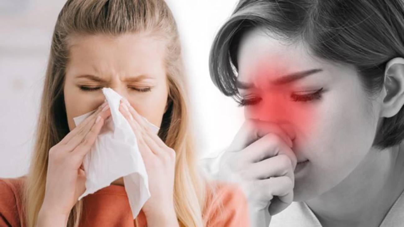 Alerjik rinit nedir? Alerjik rinit belirtileri nelerdir? Alerjlk ...