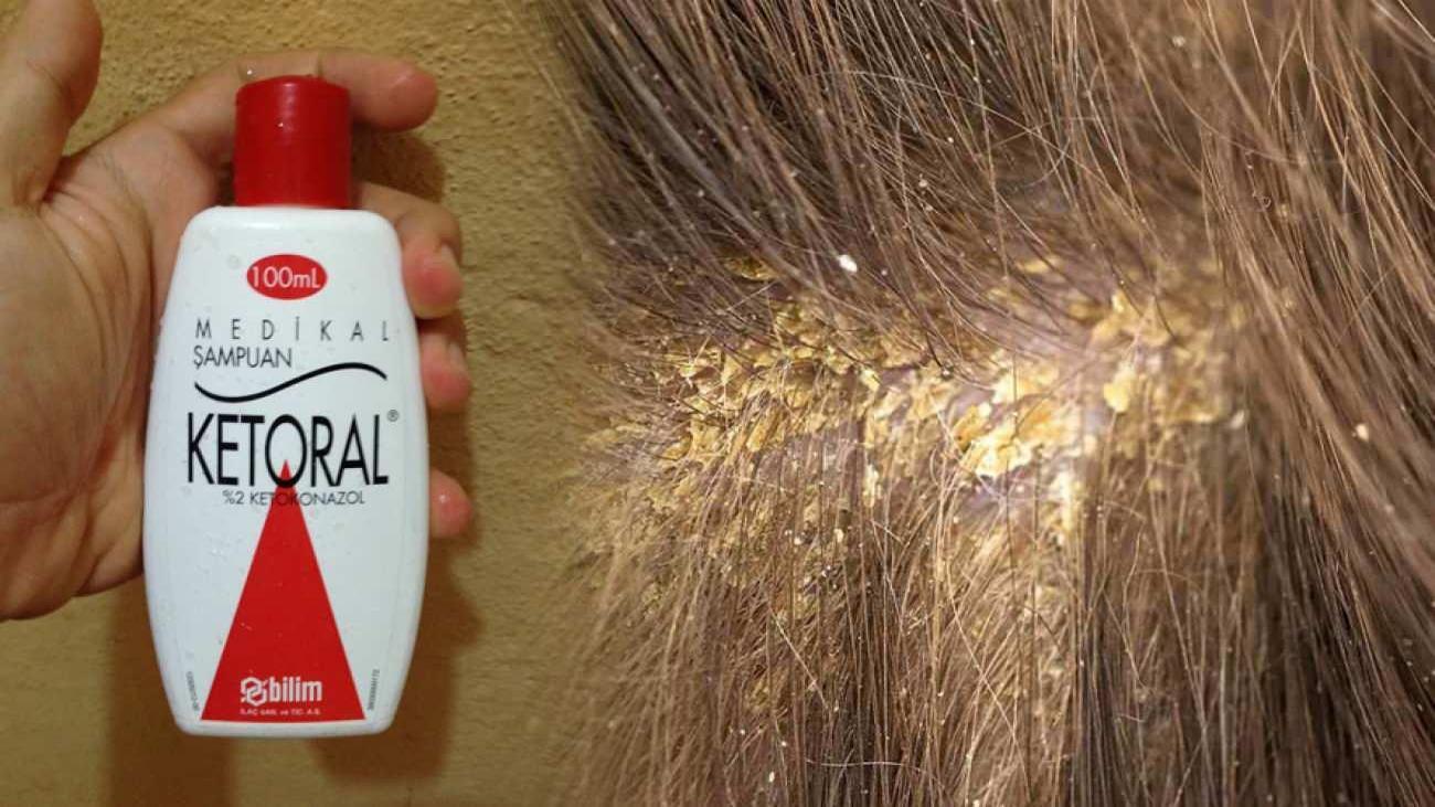 شامبو ketoral