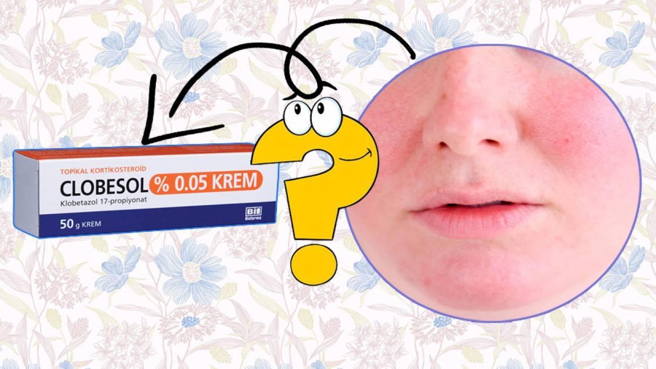 Clobesol krem nedir ve ne için kullanılır? Clobesol krem yan etkileri ...