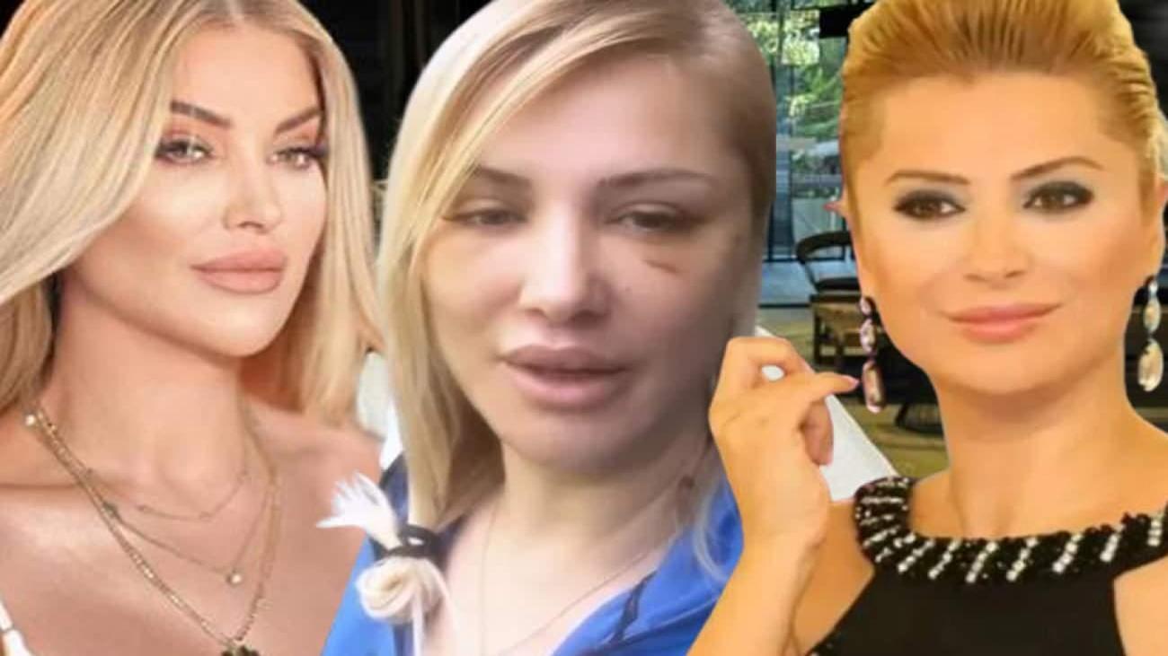 Estetiği abartan Songül Karlı resmen konuşamıyor! Songül Karlı da ...