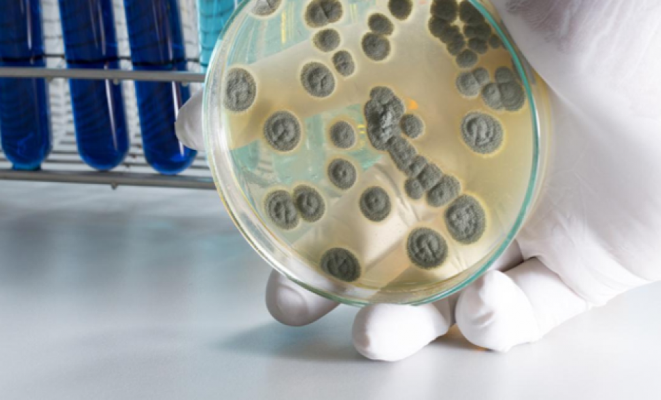 Brusella hastalığı nedir? Brusellanın belirtileri nelerdir ve tedavisi ...