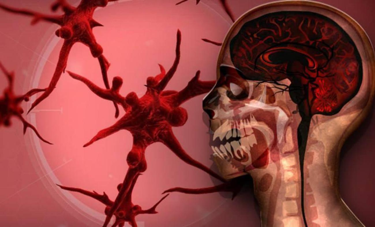 Veba hastalığı nedir nasıl bulaşır? Veba hastalığının belirtileri ...