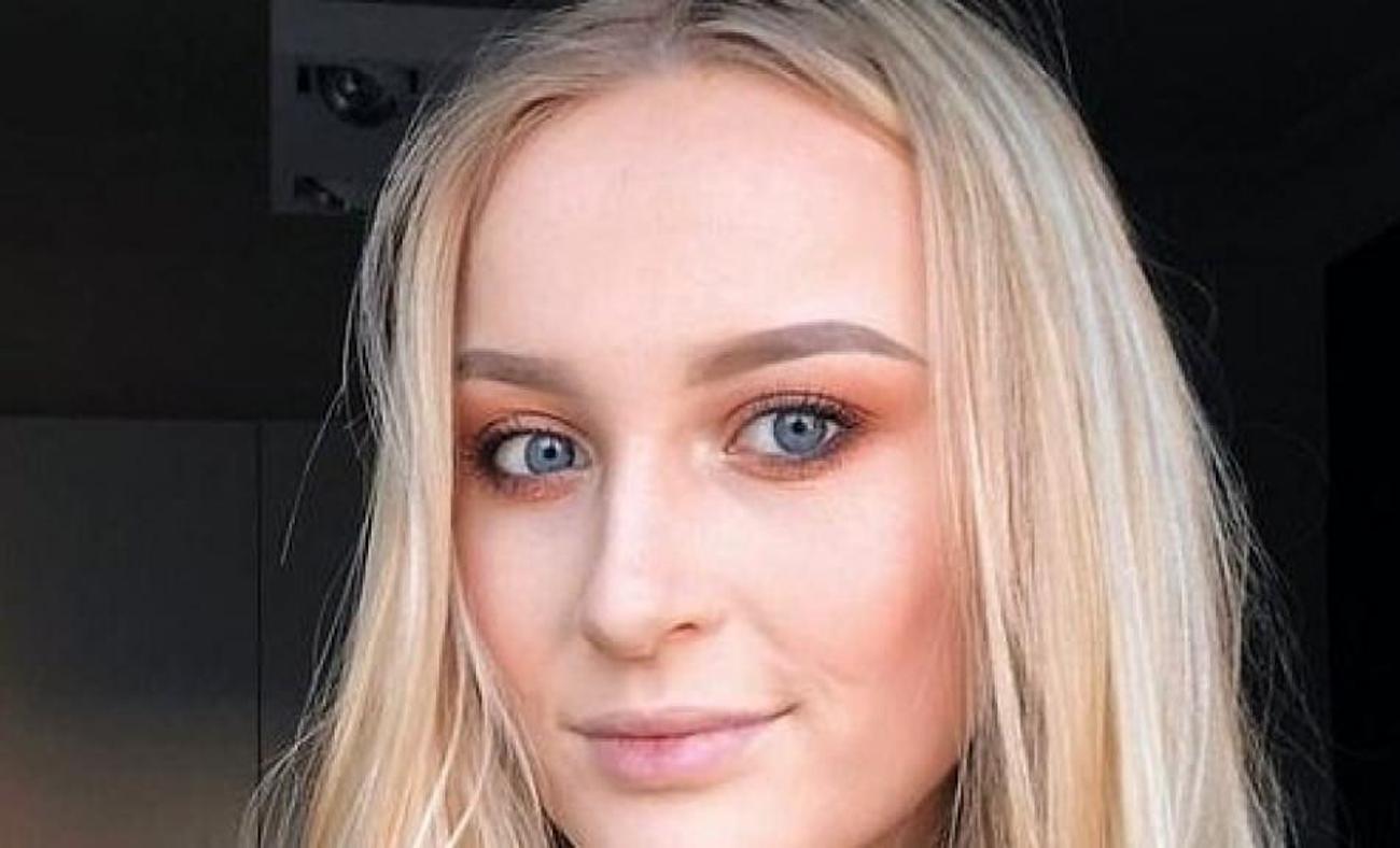 Belçikalı ünlü model erkek arkadaşından gördüğü şiddeti fotoğraflarla ...