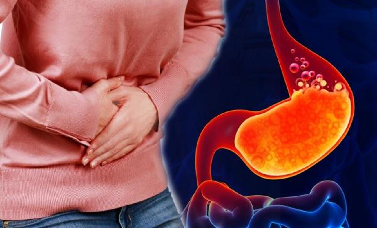 Ülser neden olur? Ülserin belirtileri nelerdir? Ülseri engellemenin ...