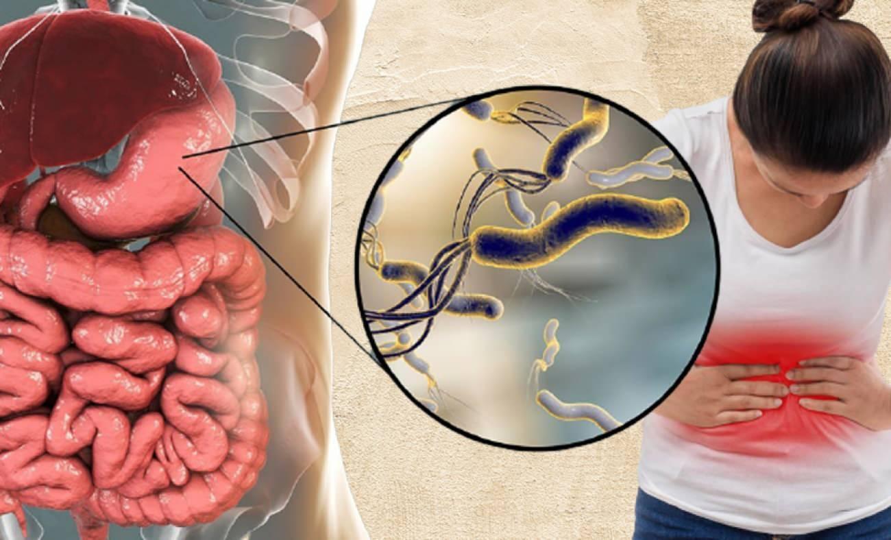 Mide mikrobu (Helicobacter Pylori) nedir? Mide mikrobunun belirtileri ...