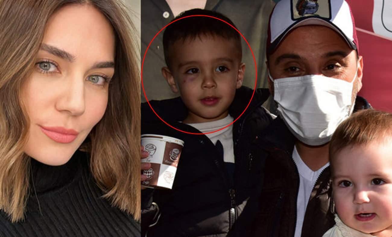 Buse Varol'un Burak paylaşımı sevenlerini korkuttu! - Magazin Haberleri