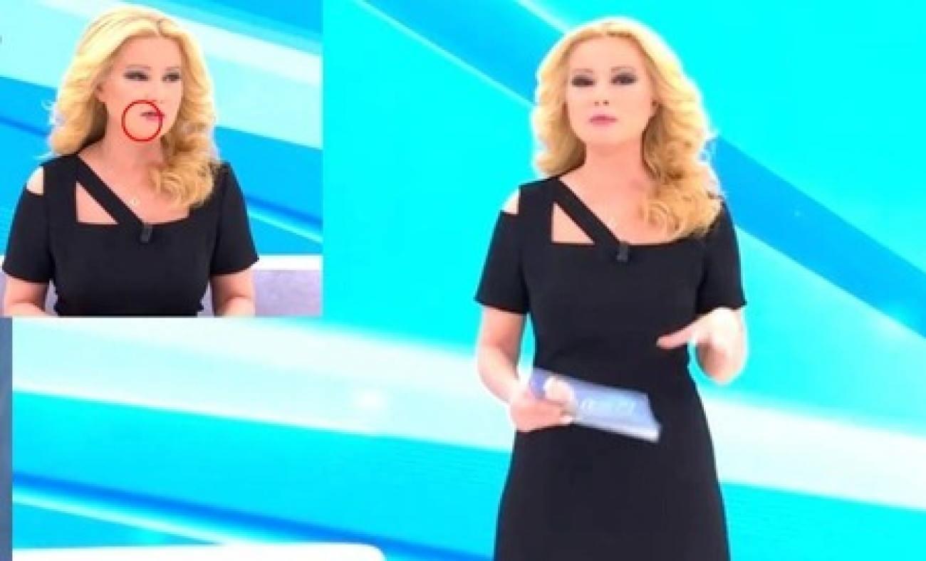 Müge Anlı'nın dudağına ne oldu? Müge Anlı'dan kötü haber dikiş atıldı ...