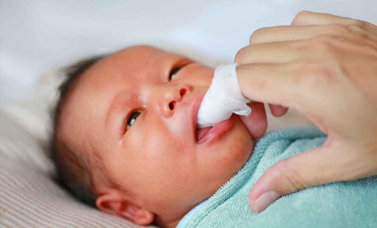 Bebeklerde damak düşmesi nedir, neden olur? Belirtileri ve tedavisi ...