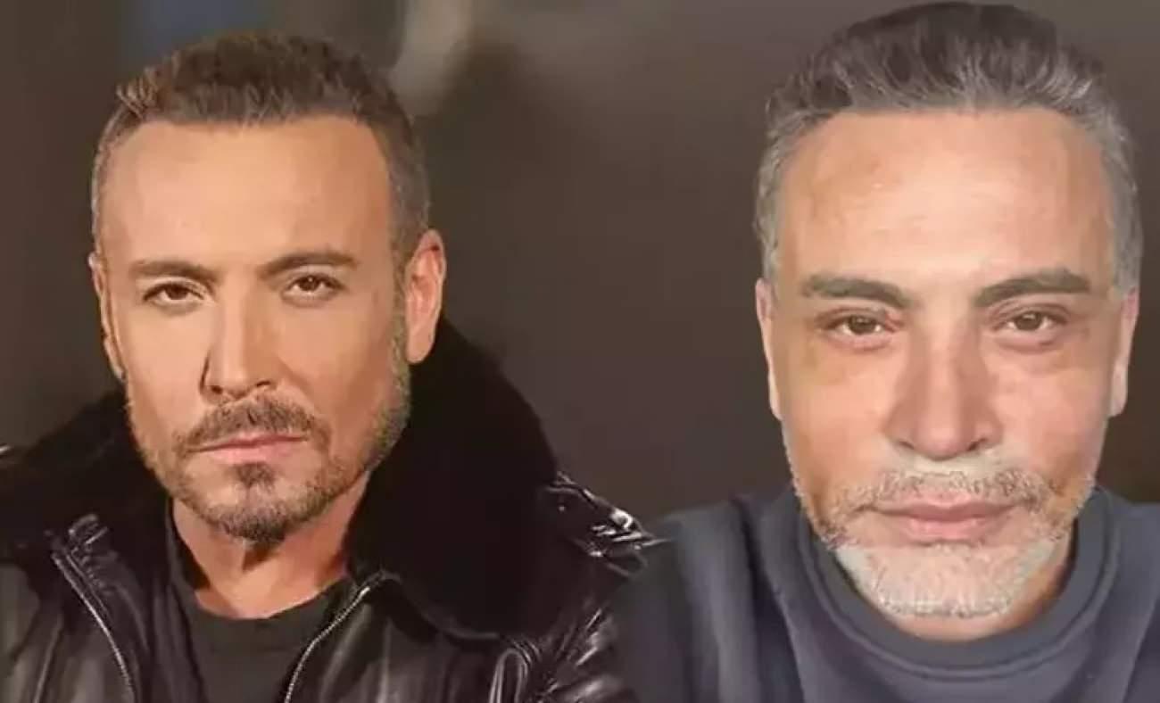 Yüz gerdirme ameliyatı olan Cenk Eren'in estetik faturası ortaya çıktı ...